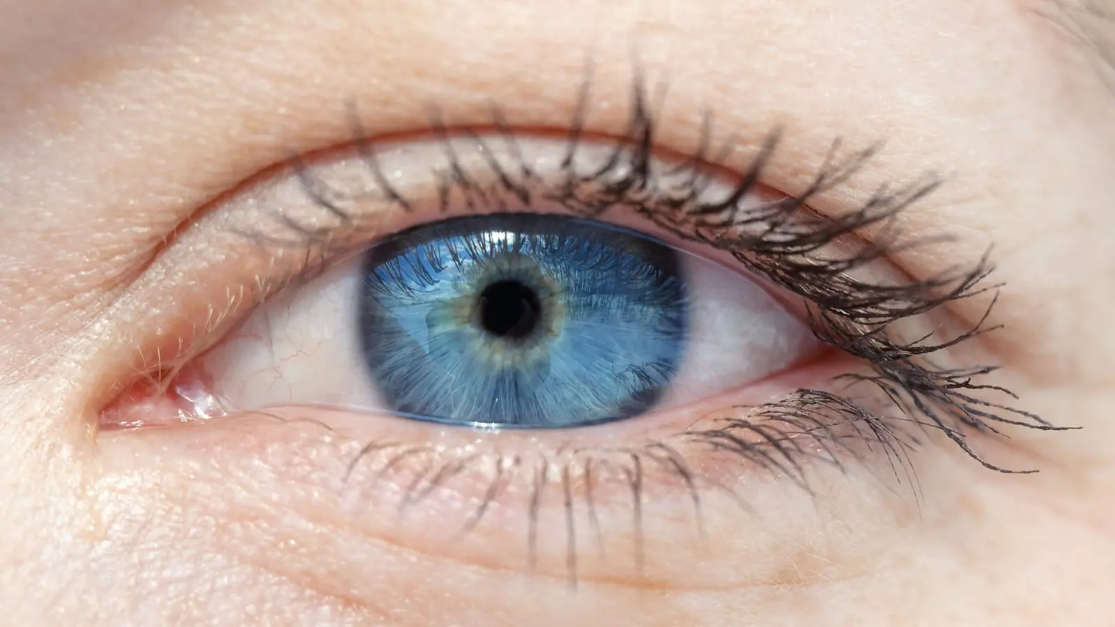 Understanding Nystagmus: Causes, Symptoms, and Natural Approaches